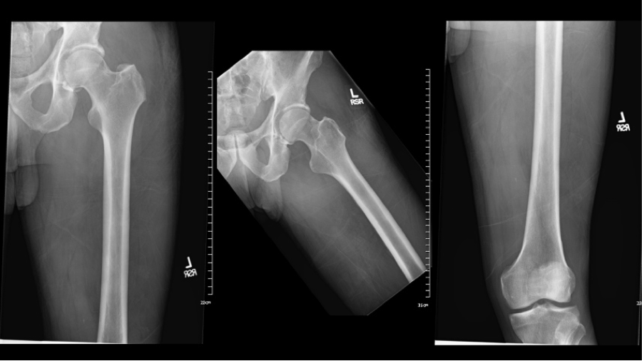 Case of the Week COW #12 – St. Joseph's University Medical Center ...